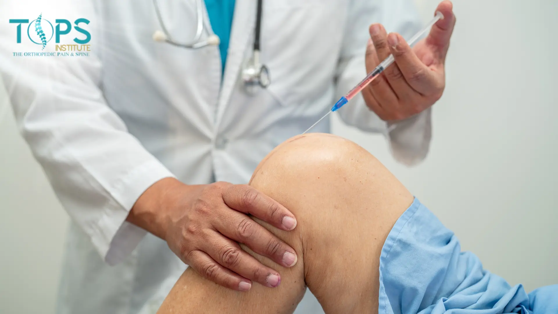 PRP for Joint Pain: Surgery Alternative?
